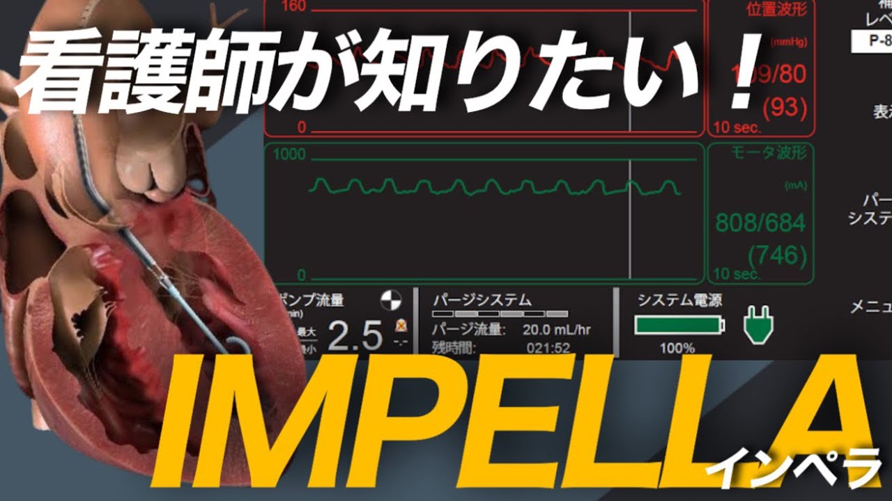 IMPELLA（インペラ）の管理と看護について要点を絞って解説！ - YouTube