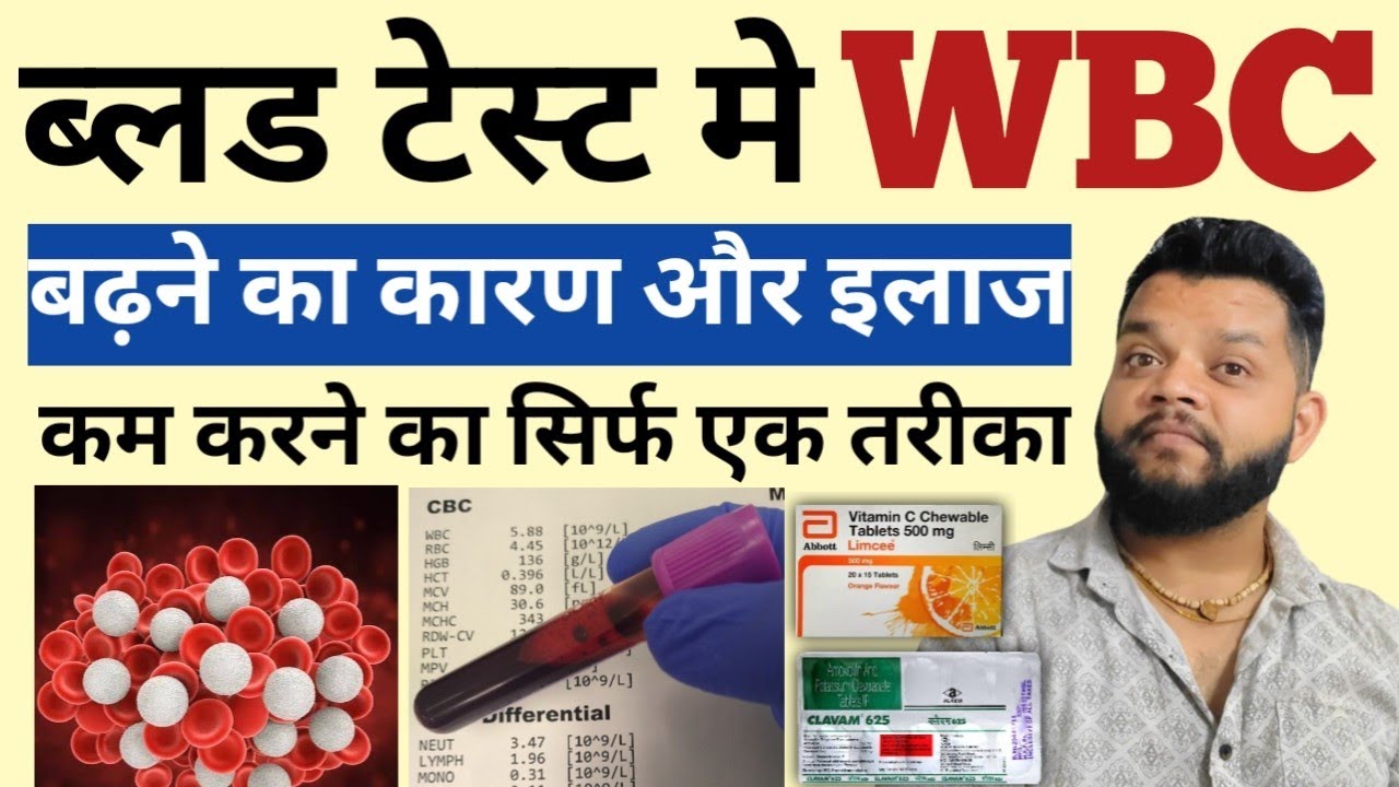 WBC बढ़ने पर ये इलाज दें | How To Reduce WBC in Blood | Read CBC Report ...