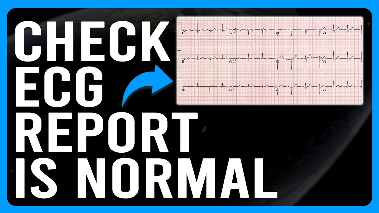 How To Check ECG Report Is Normal How To Check Your ECG Report For
