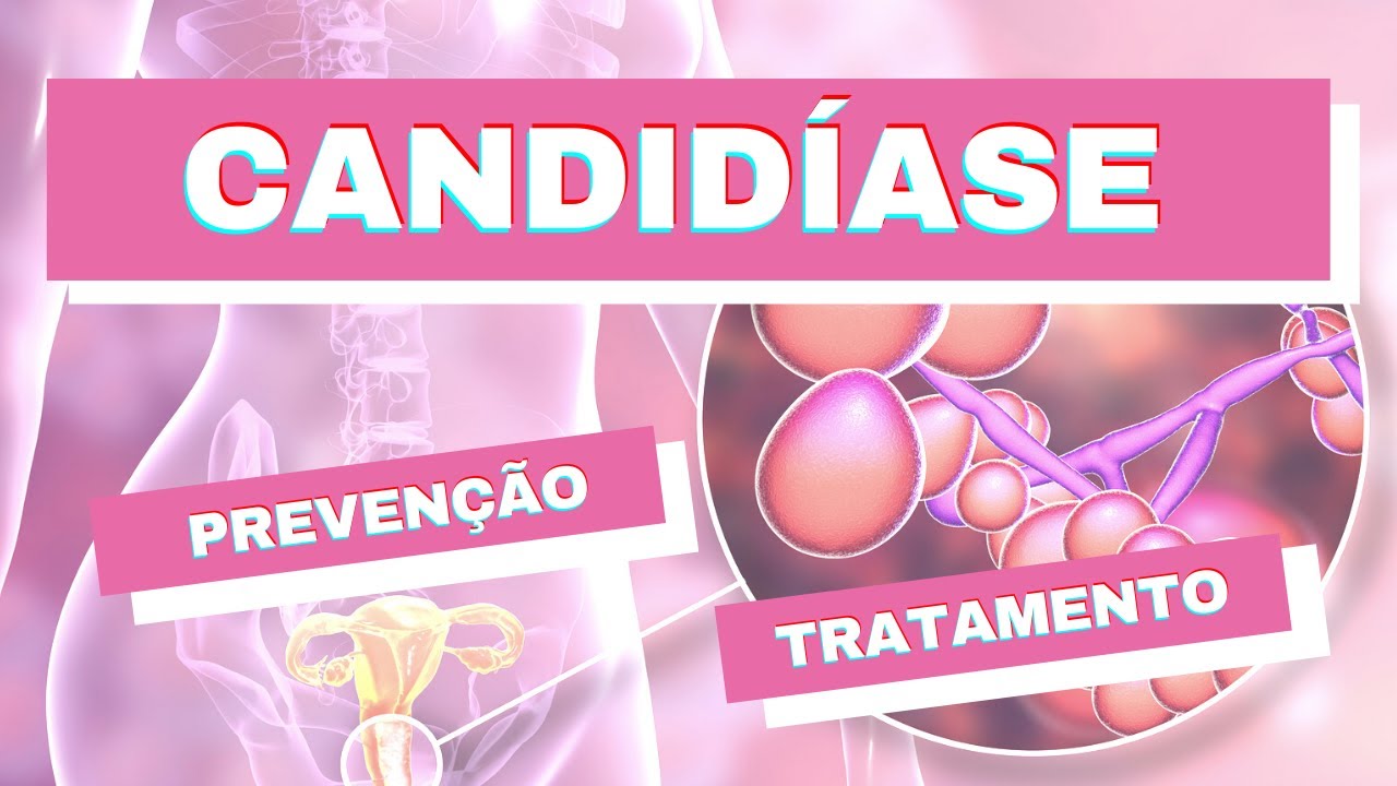 COMO EVITAR A CANDIDÍASE? PREVENÇÃO E TRATAMENTO! - YouTube