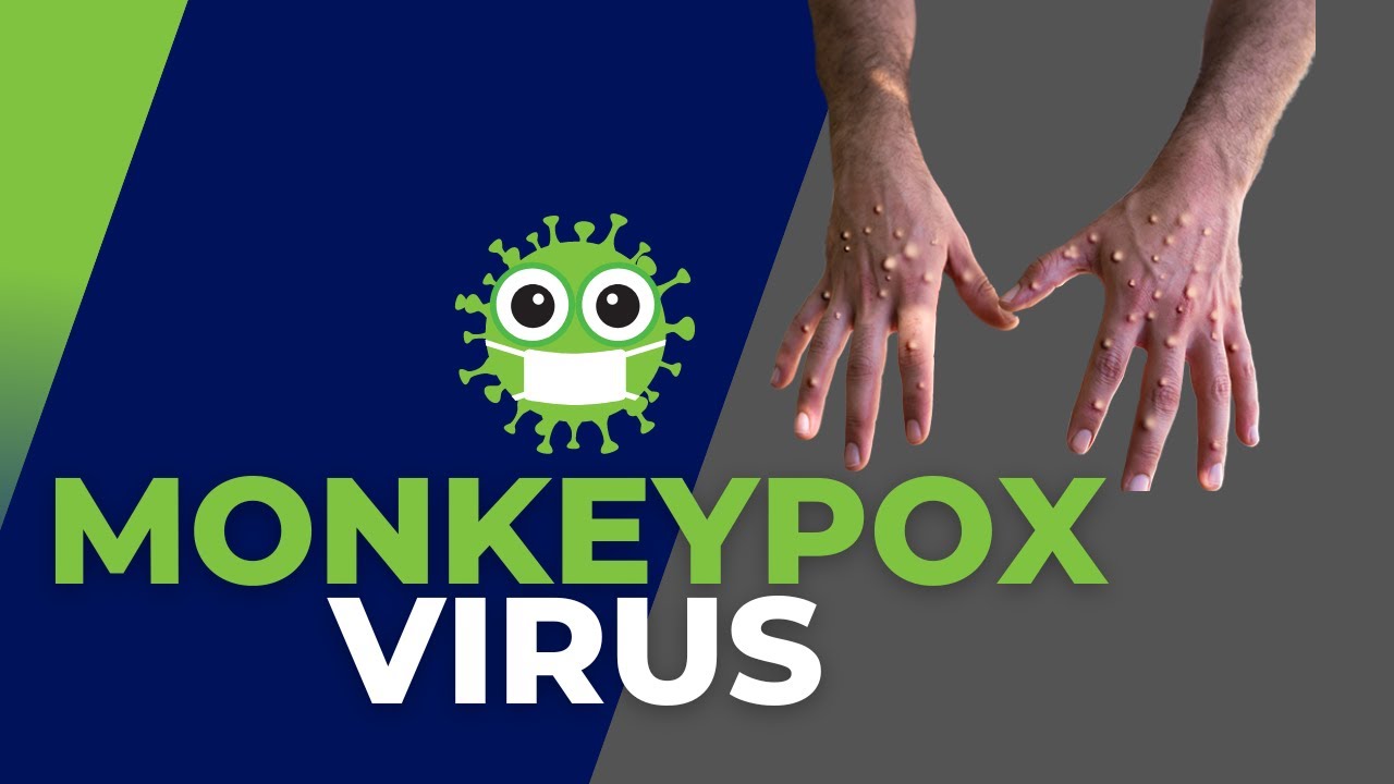 Monkeypox Virus | Signs and symptoms | Transmission | lab test ...