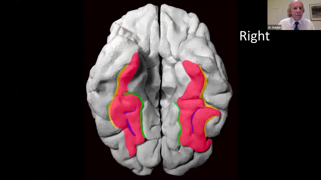 Lecture: The Cerebral Visual Impairments: Diagnosis and the Principles ...