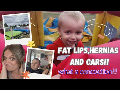What Do Fat Lips, Hernia's And Classic Cars Have In Common? A Week With The Butlers That's What!!