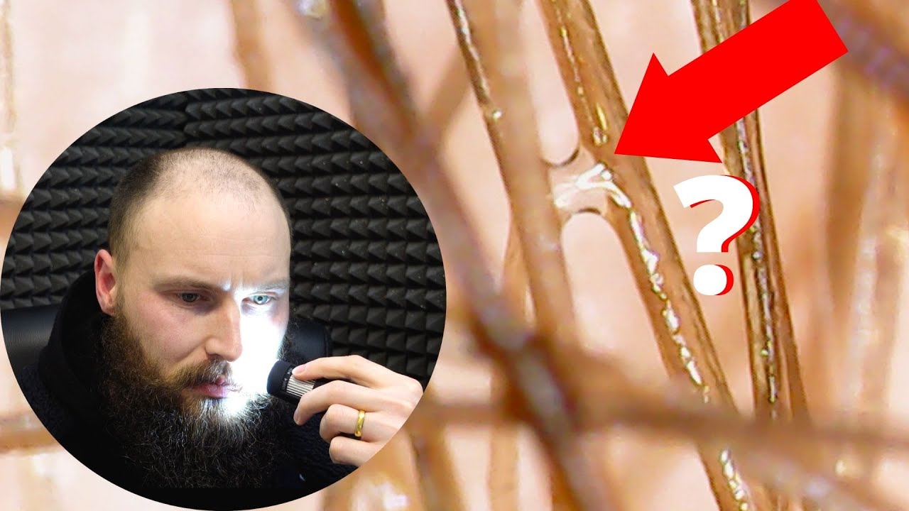 My BEARD At 1000x MAGNIFICATION - Incredible! - YouTube