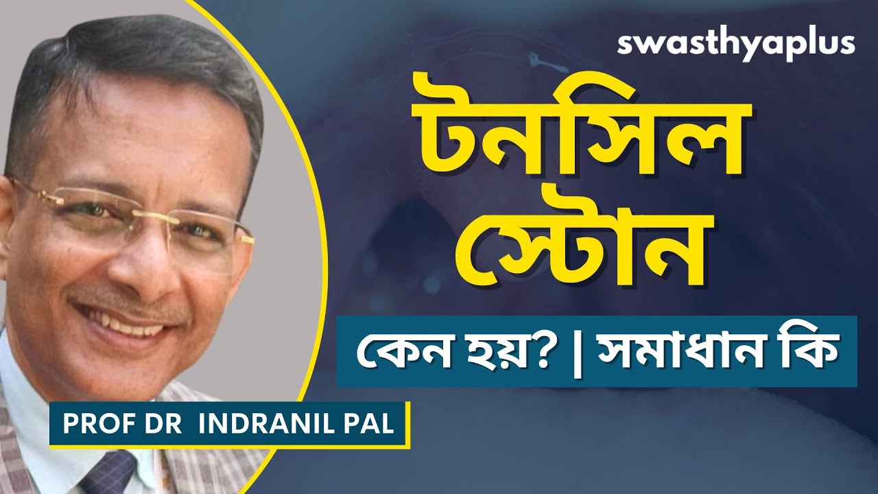টনসিল স্টোন কী? কেন হয়? | Tonsil Stone - How to Treat? in Bangla | Prof Dr Indranil Pal - YouTube