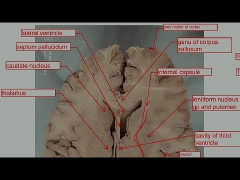 Understanding the Transverse Section of the Brain - YouTube