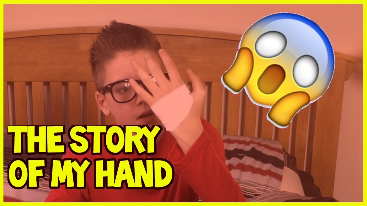 The Story Of My Hand A horrible injury :( - YouTube