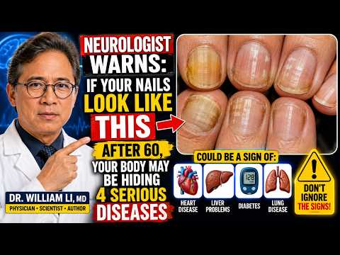 Neurologist Warns: If Your Nails Look Like THIS After 60, Your Body May Be Hiding 4 Serious Diseases