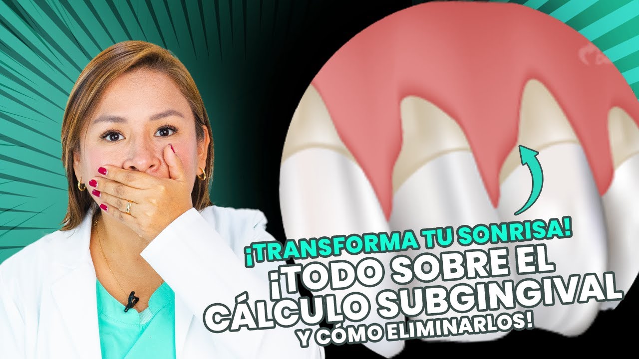 Cálculo Subgingival: ¿Por Qué Es un Riesgo Silencioso para Tus Encías ...