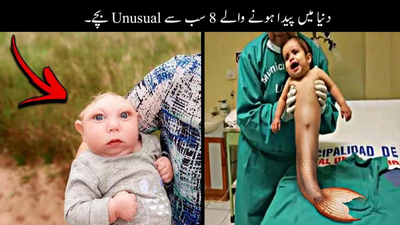 8 Most Unusual Kids Ever Born | دنیا میں موجود سب سے انوکھے بچے ...