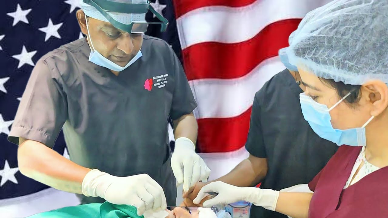 Rhinoplasty amazing results | USA lady nose splint removal | before ...