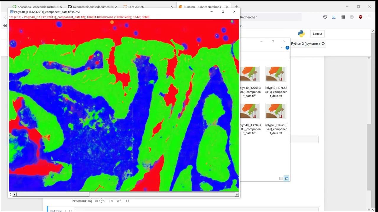 Deep Learning For Biologists Tissue Segmentation Unet Processing Python Youtube