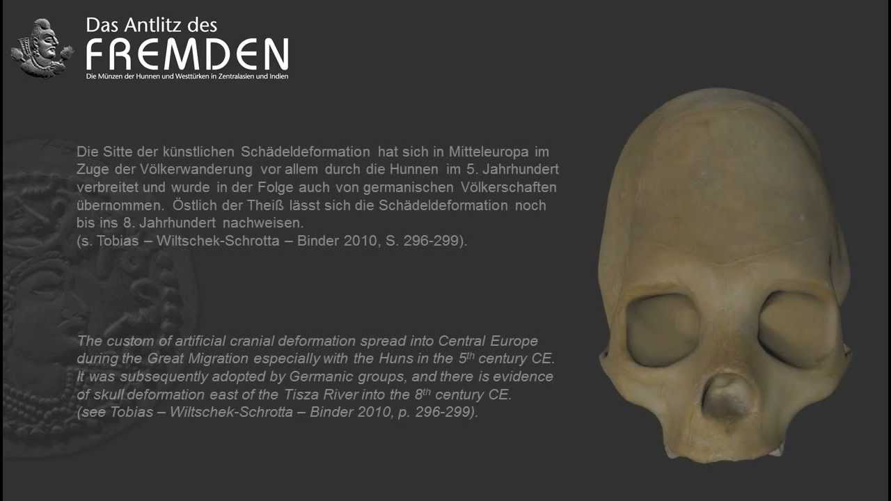 Der Hunnenschädel Schädeldeformationen - YouTube