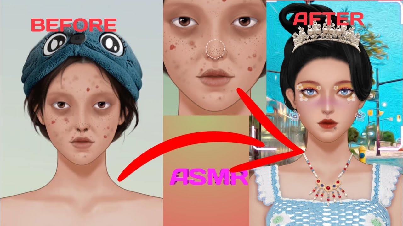 Asmr Pimple Removal animation | Asmr Satisfying Juicy Pimple Extraction ...