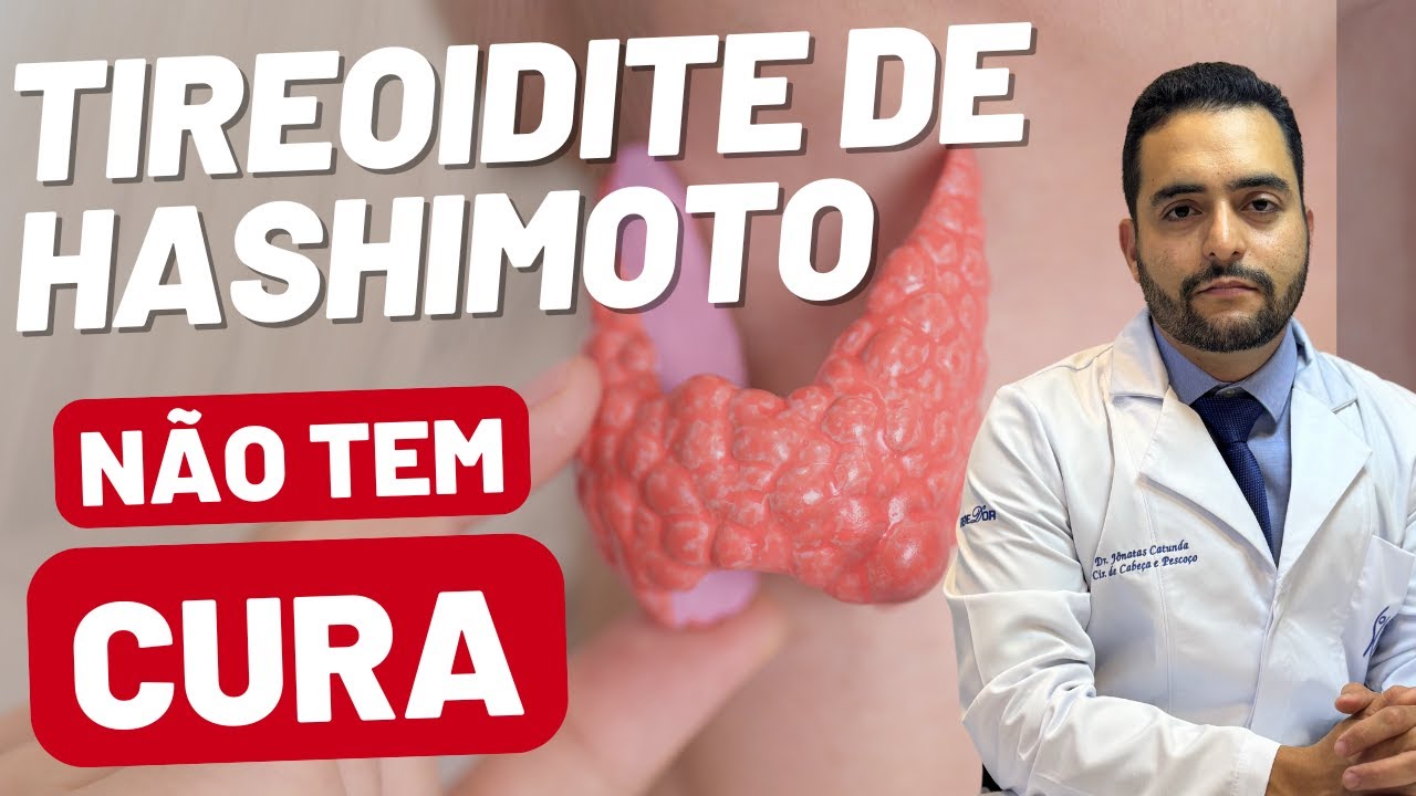Hashimoto: Entenda por que não tem cura e como viver bem com a doença ...