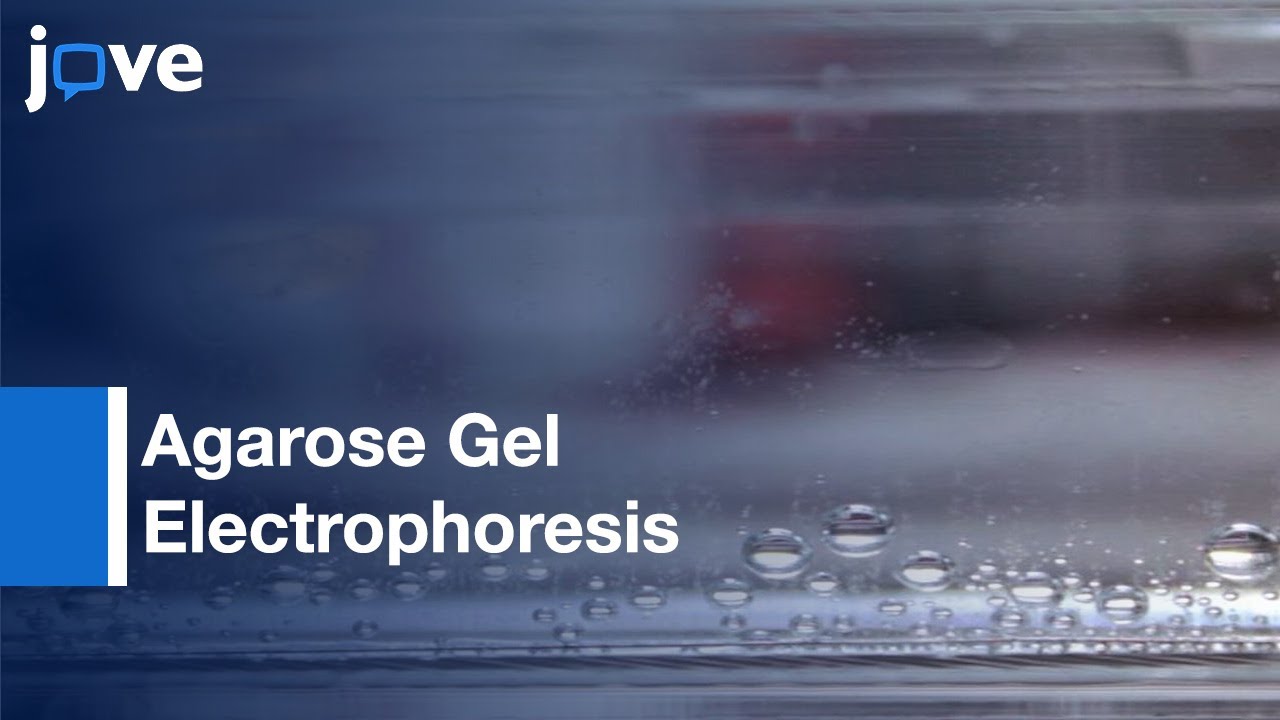 Agarose Gel Electrophoresis For The Separation: DNA Fragments l ...