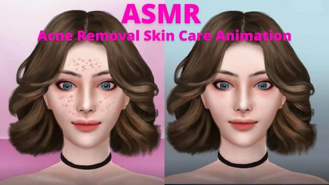ASMR face acne removal skin care l ASMR makeup animation 2022 - YouTube