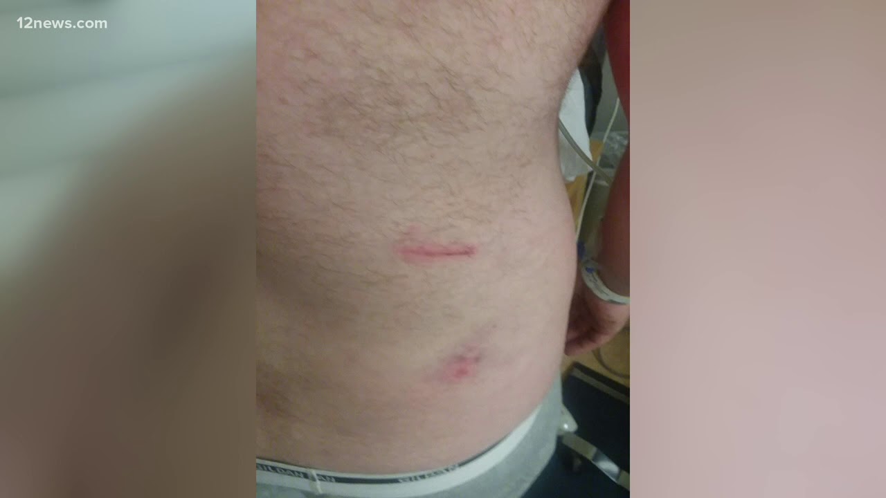 Man attacked by Banner security after experience a medical episode ...