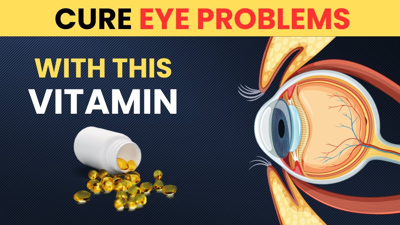 One Vitamin to Cure Eye Problem Permanently | Vitamins | Eye care Tips ...