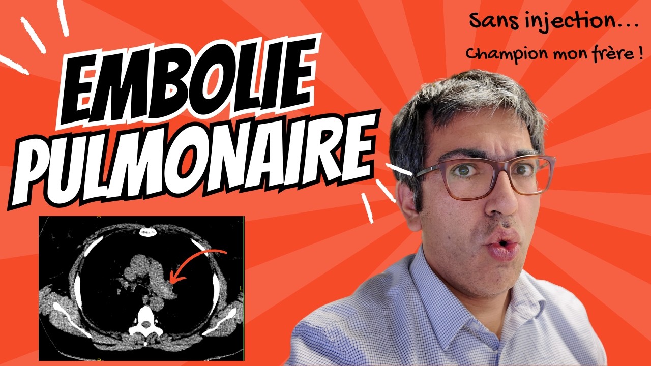 Le diagnostic exceptionnel : Embolie Pulmonaire sur scanner SANS ...