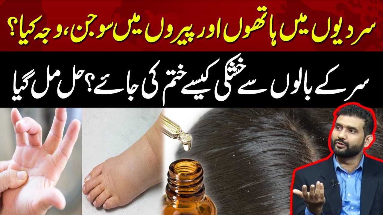 Sardiyon Mei Howe Sozish Aur Balon KI Khushki Ko Khatam Krain | Good ...