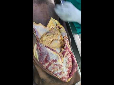Live Postmortem Examination Of A Case Of Death Under Suspicious/Unknown Circumstances (Sec 174 CrPC)