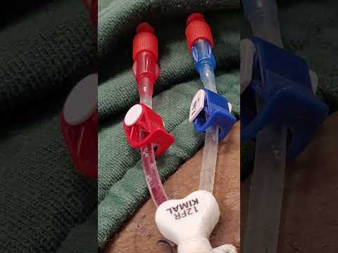 Femoral Catheter Removal - YouTube