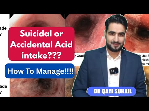 Acid & Alkali Ingestion: Emergency Management Explained | Gastroenterology Lecture