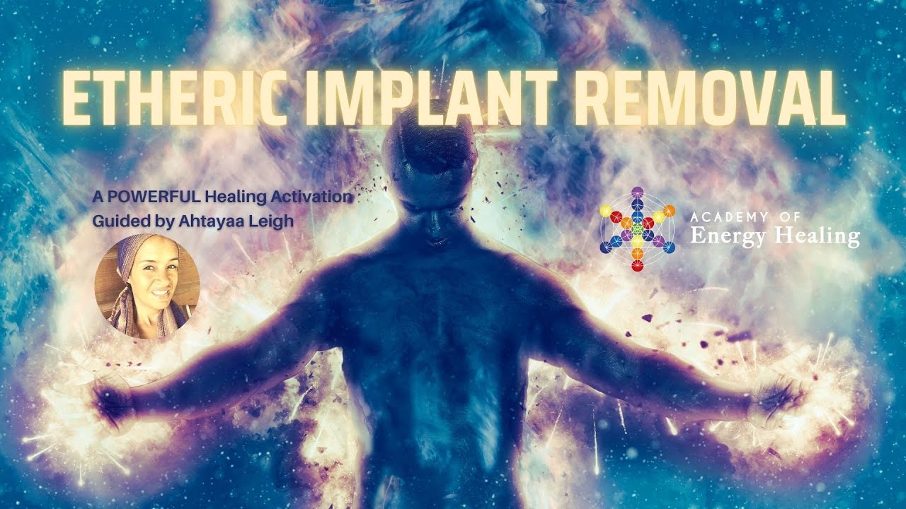 Etheric Implant Removal - YouTube