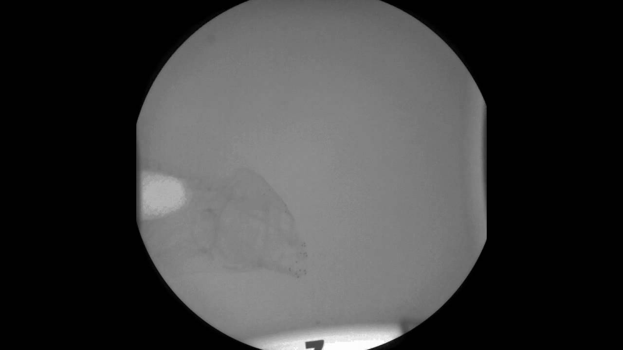 XROMM: Fish Feeding: x-ray video of jaw protrusion in common carp ...
