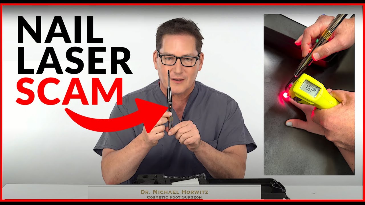 Nail Laser Scams: DIY - Home Fungus Toenail Lasers - Do They Really ...