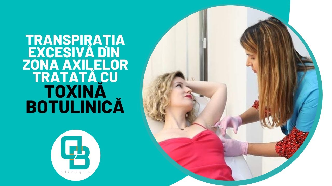 Tratamentul transpiratiei excesive / hiperhidroza | DermaBeauty ...