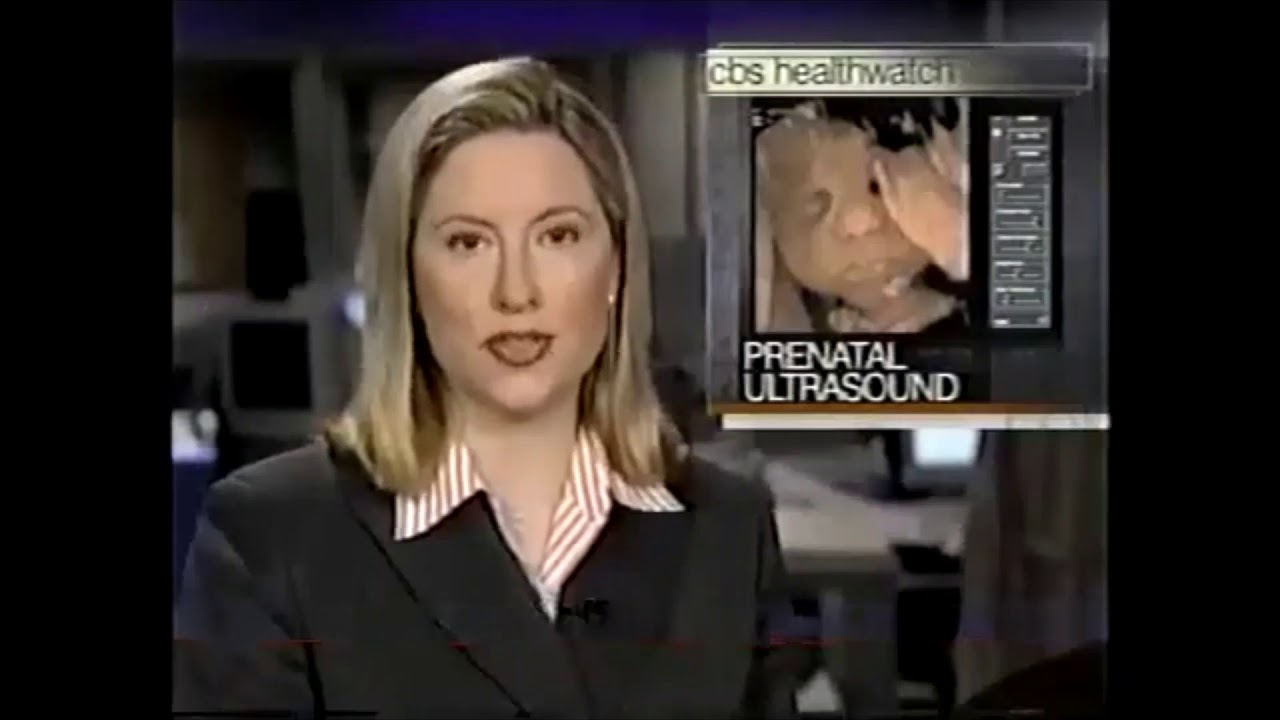 CBS HealthWatch sponsored by Procrit - December 18, 2001 - YouTube