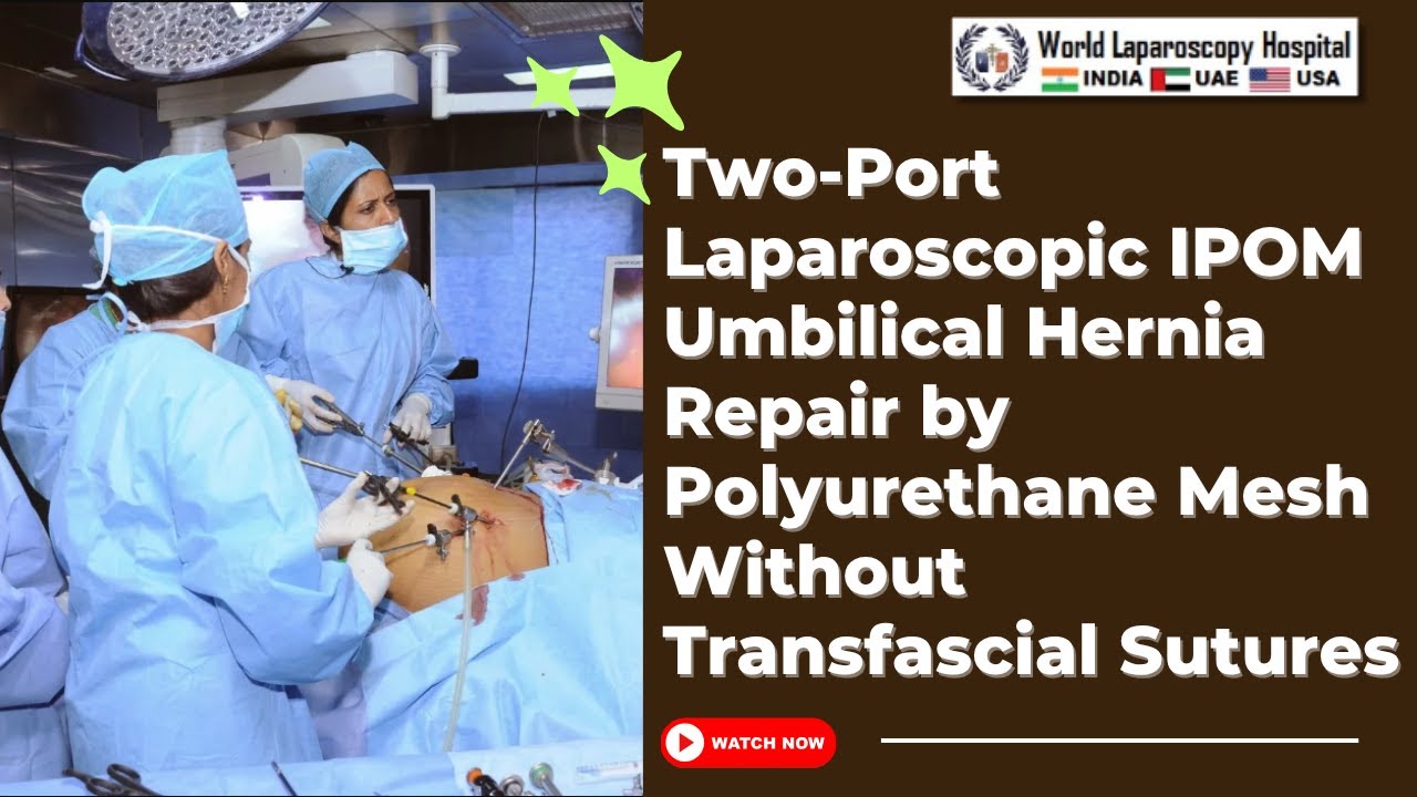 Two-Port Laparoscopic IPOM Umbilical Hernia Repair by Polyurethane Mesh ...