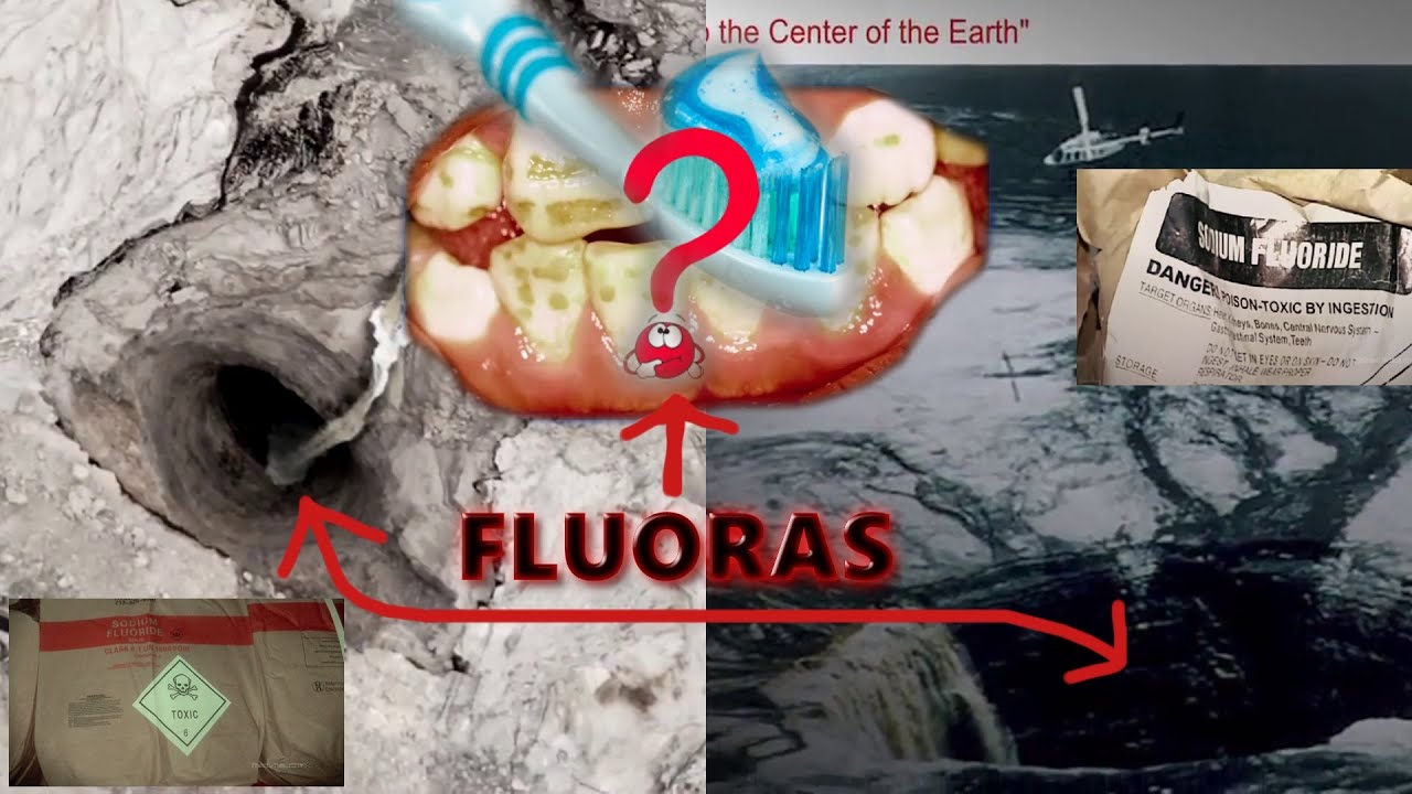 FLUORAS - Didžioji apgaulė? (Dokumentinis filmas) Paulo Wittenbergerio ...