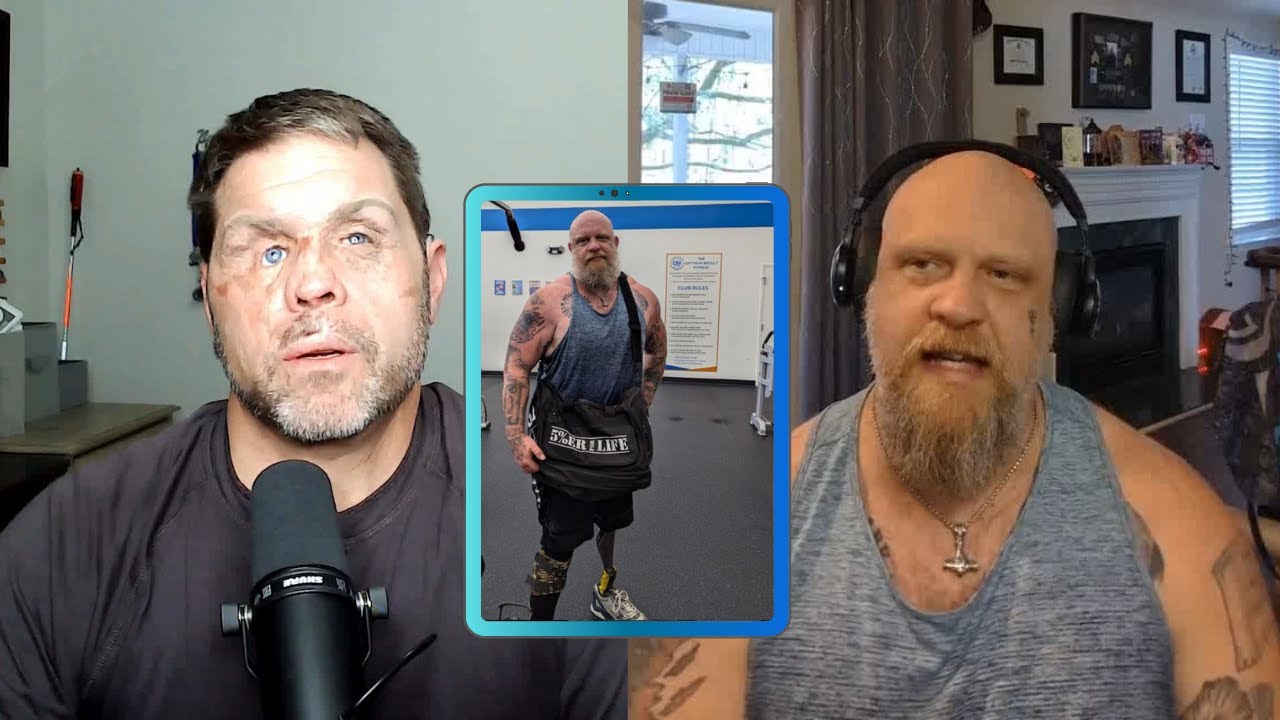 How Did Brian Conwell's Life Change After Losing Both Of His Legs ...