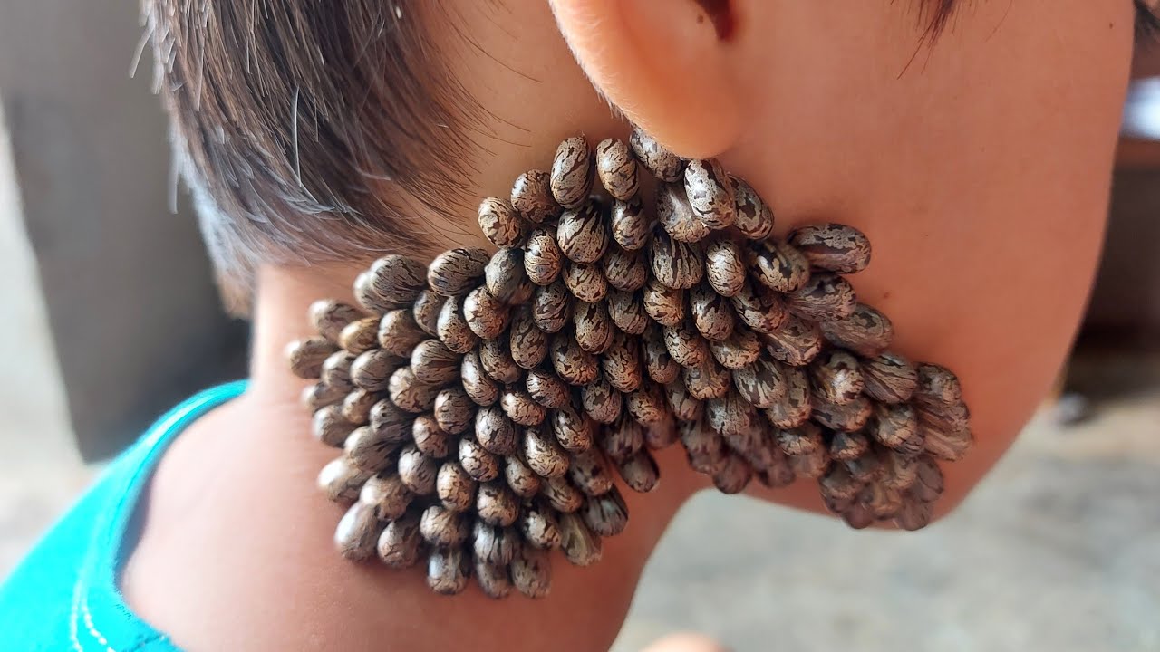 Bugs and plaque in the neck #111 - YouTube