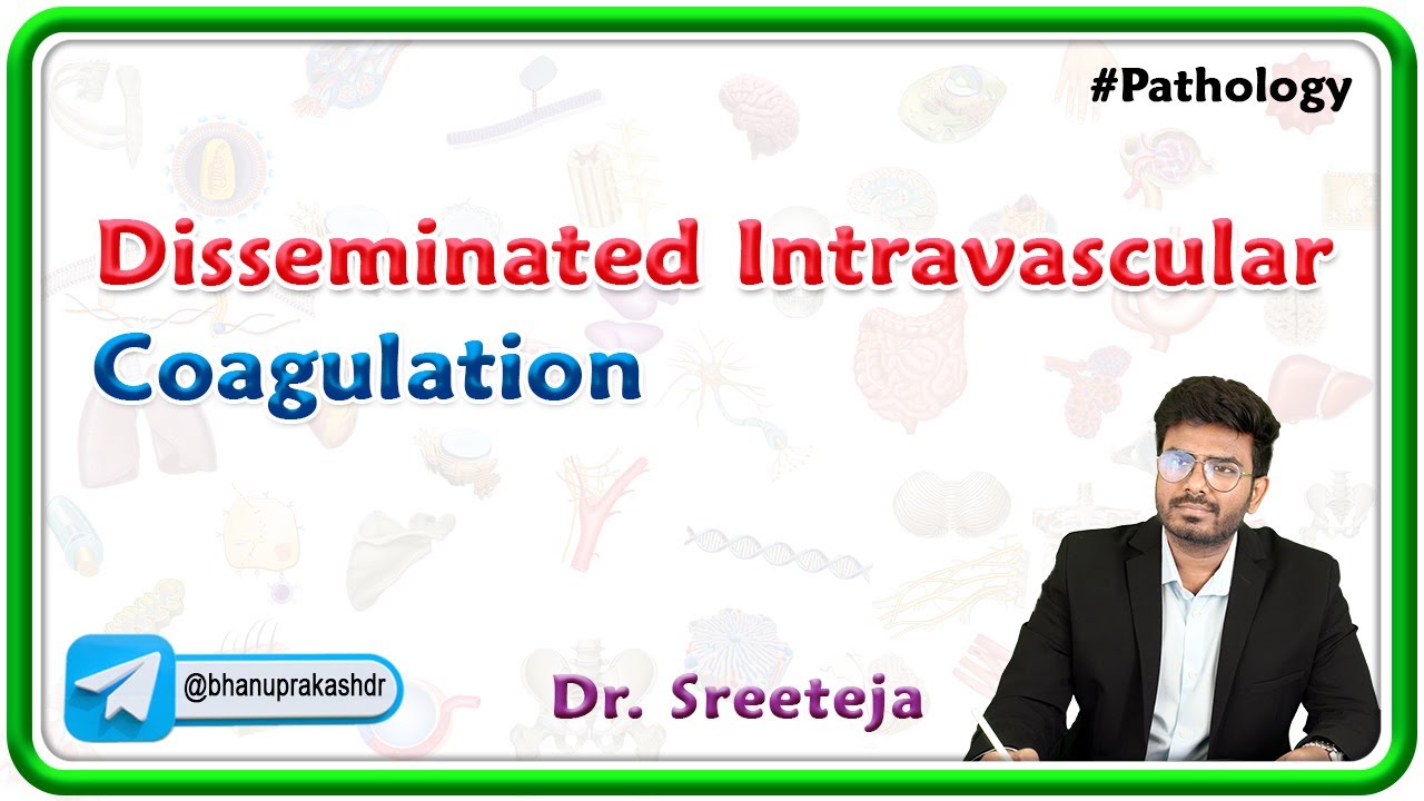 12. Disseminated Intravascular Coagulation (DIC) | USMLE Step 1 ...