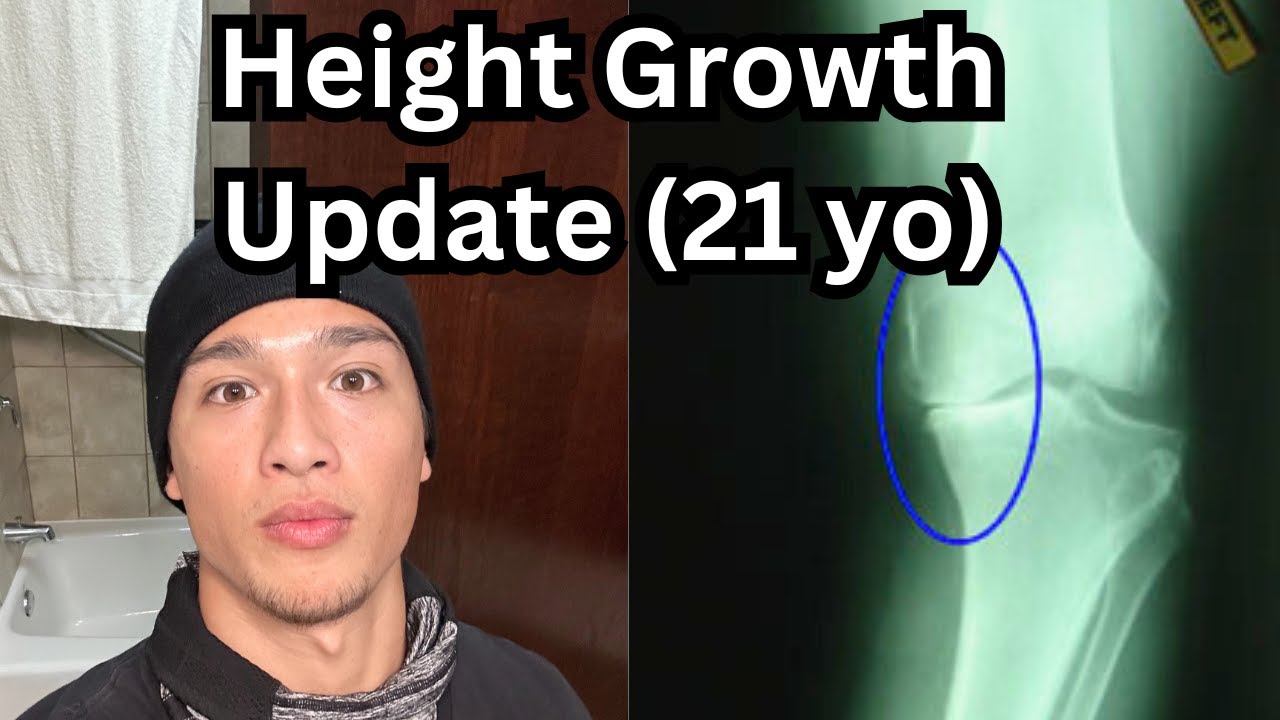 I did banded sleeping for 2 months. Here's a quick update - YouTube