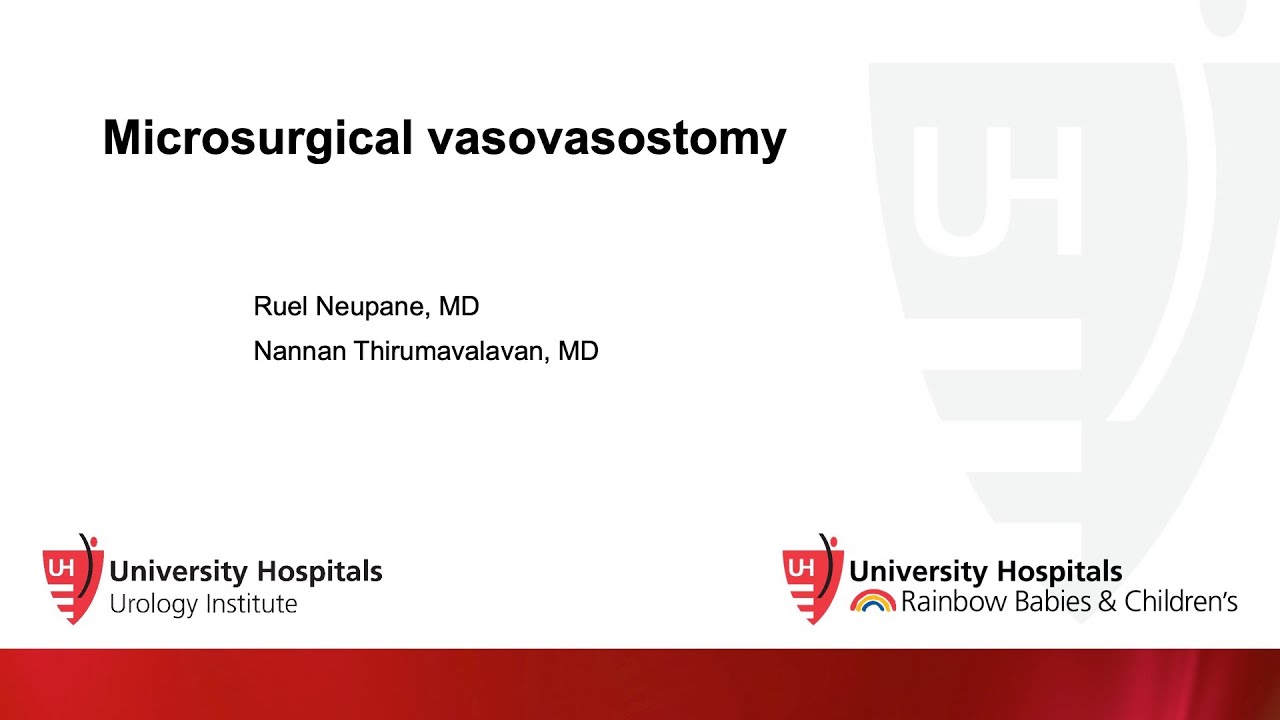 University Hospitals Cleveland: Vasectomy Reversal - Microsurgical ...