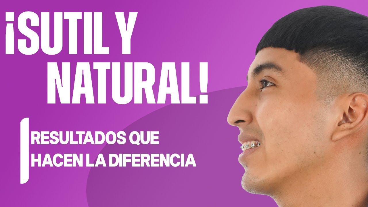 ¡SUTIL Y NATURAL! RESULTADOS QUE HACEN LA DIFERENCIA - YouTube