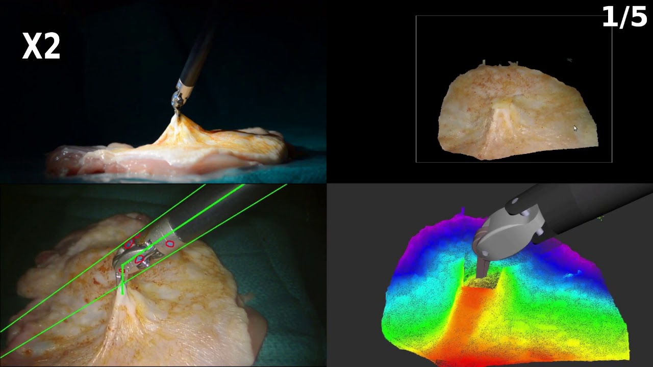 SuPer: A Surgical Perception Framework for Endoscopic Tissue ...