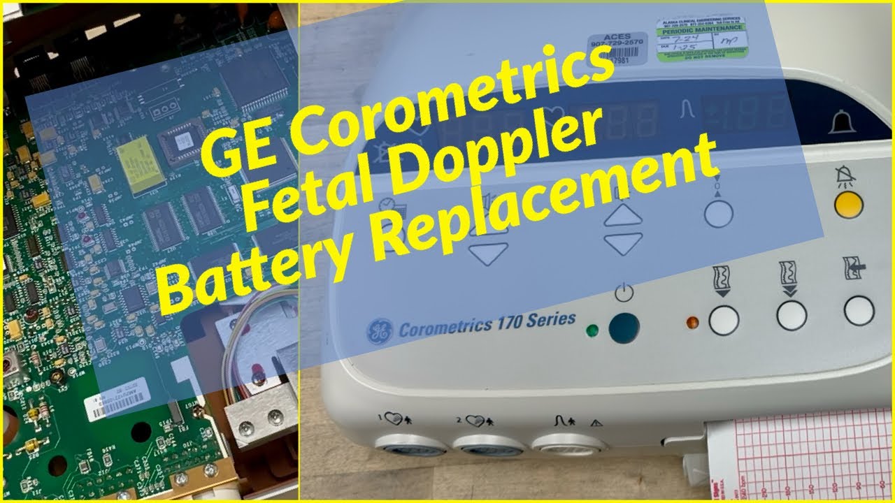 GE Corometrics 170 Fetal Doppler Battery Replacement & Fix for Date ...