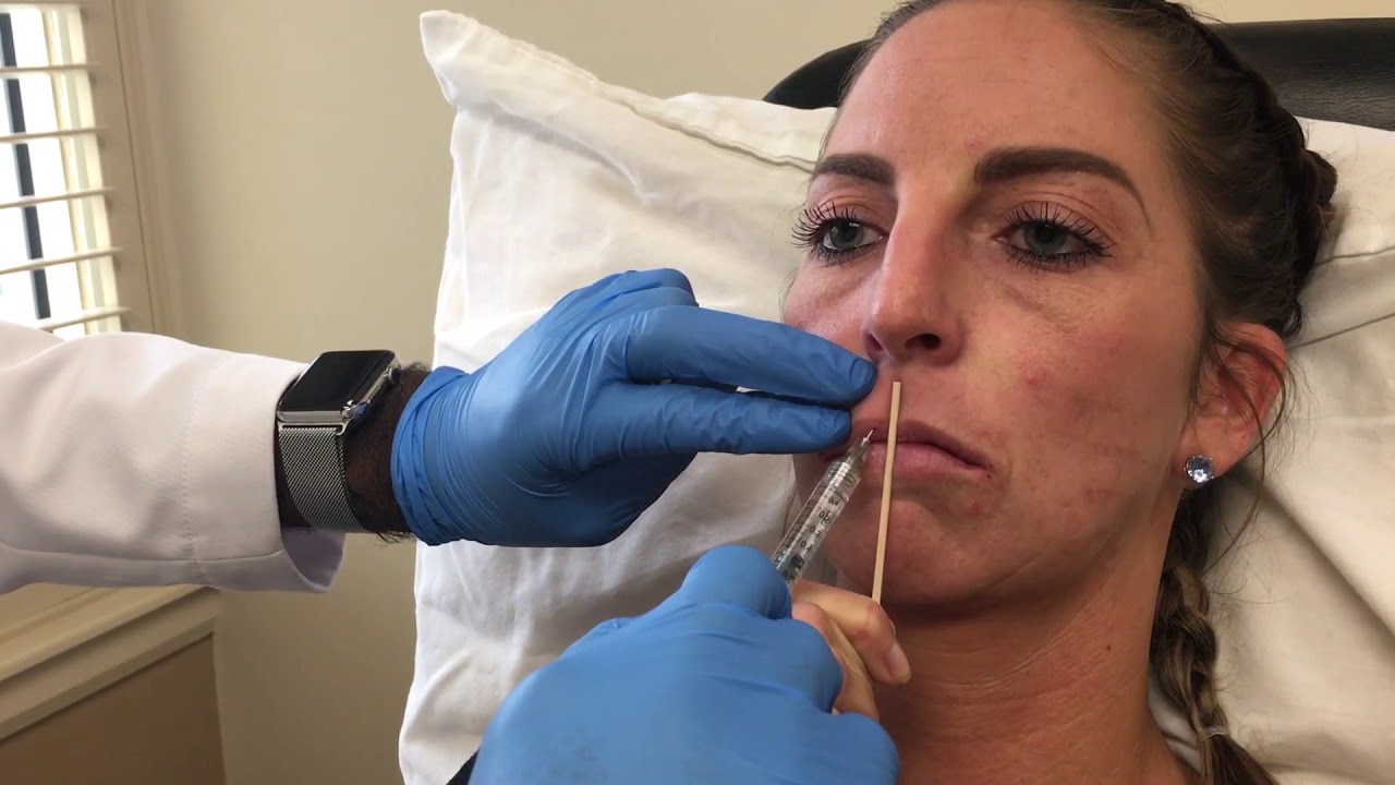 Dr. Narasimhan performs the keyhole technique for enhancing the cupids ...