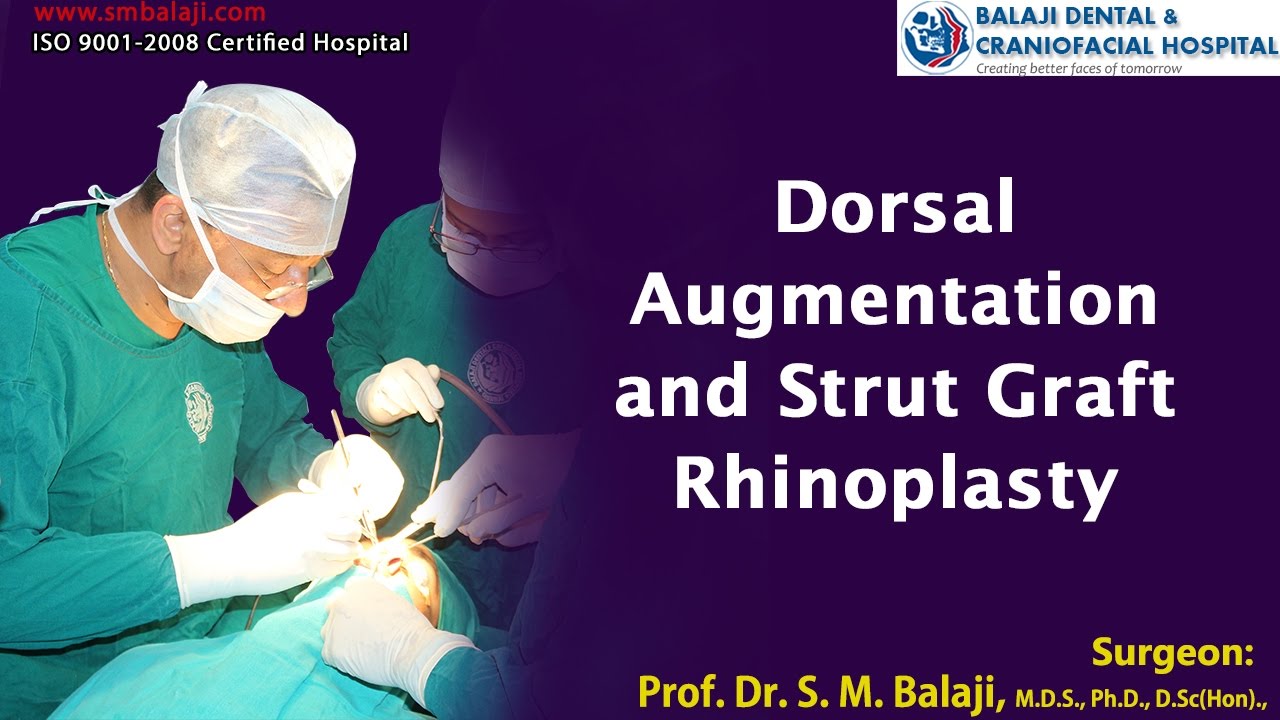 Dorsal Augmentation and Strut Graft Rhinoplasty - YouTube