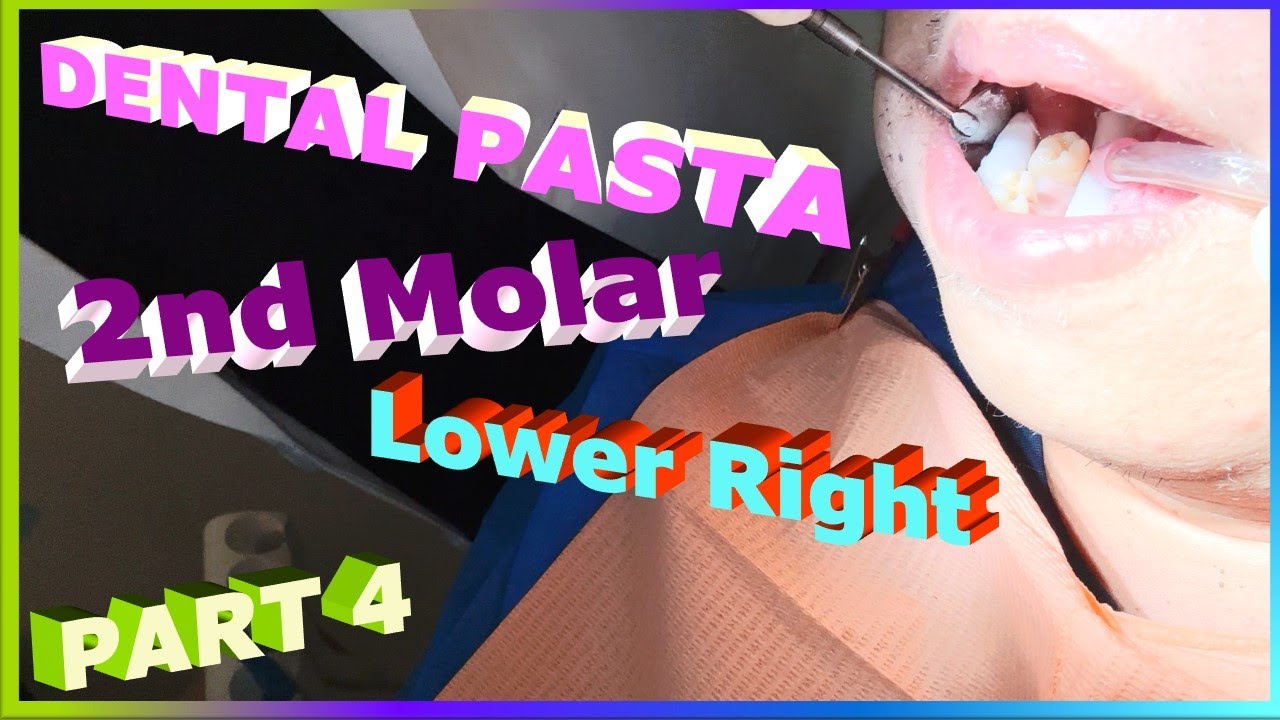 Dental Pasta | Santoria Dental | Dental Care | Part 4 | Shorts - YouTube