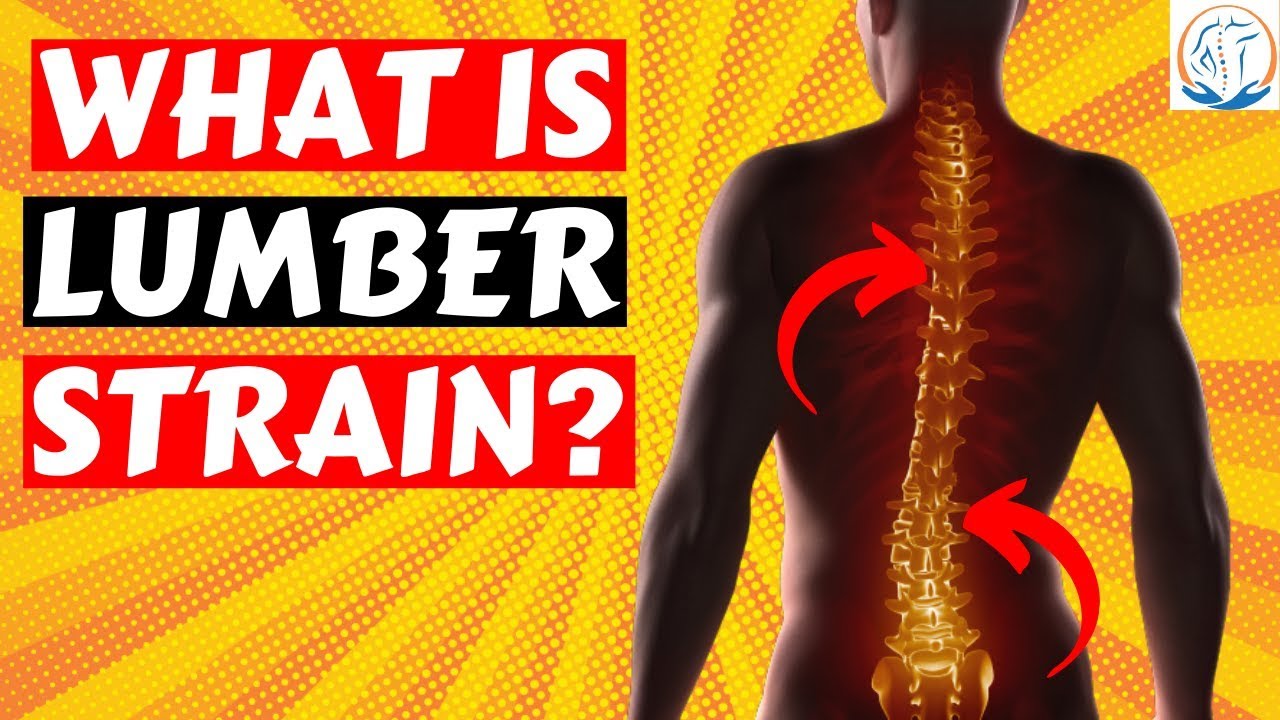 Causes, Symptoms and Treatment of Lumber Strain - YouTube