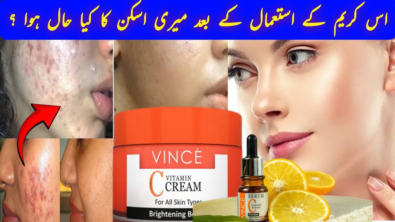 Vince Vitamin C cream Review|Vince Vitamin C serum| Vince |Best ...