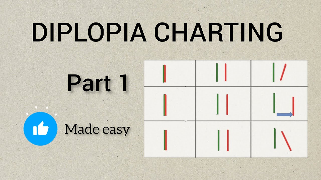 DIPLOPIA CHARTING PART 1 | Basics of diplopia charting | Optometry ...