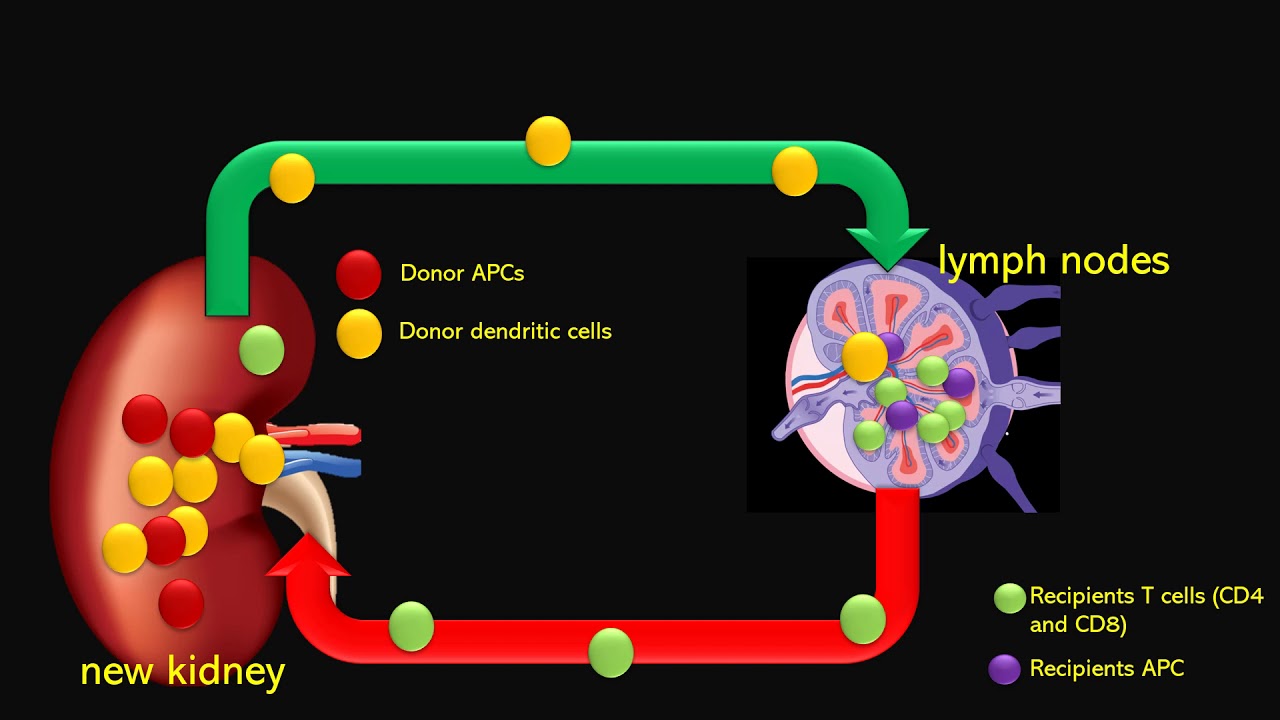 Eduvisual Acute Cellular Rejection - YouTube